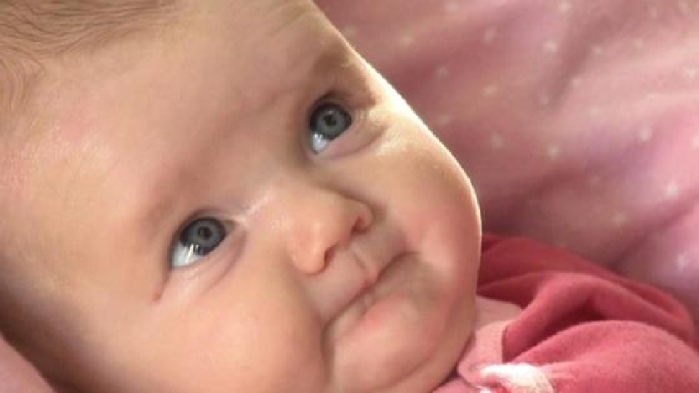 Baby's Rare Skin Disease Leaves Her Untouchable | WTTE